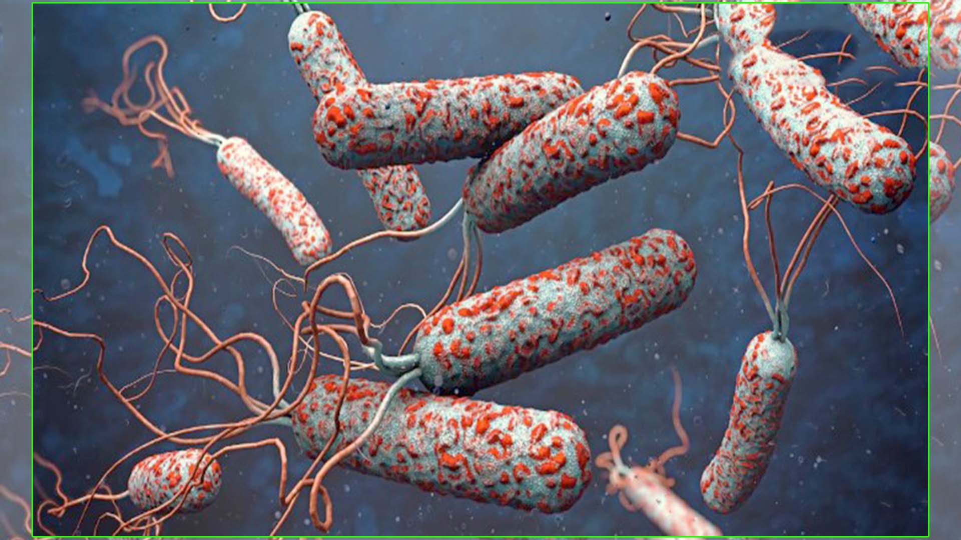 ४५ जनामा हैजा सङ्क्रमण पुष्टि, के हुन् हैजाबाट जोगिने उपाय ? | Bagmati ...